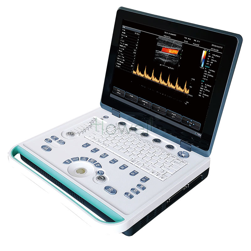Colour Doppler Ultrasound Machine HE-E80 | Howell Medical